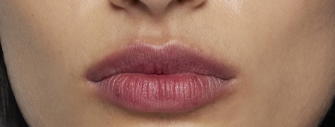 Bitten lips o labios mordidos. Qué son y cómo se hacen