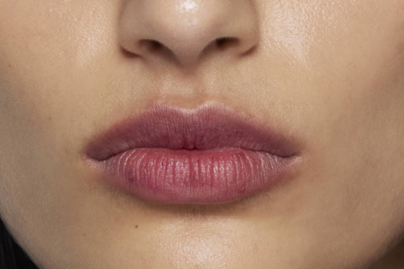 Bitten lips o labios mordidos. Qué son y cómo se hacen